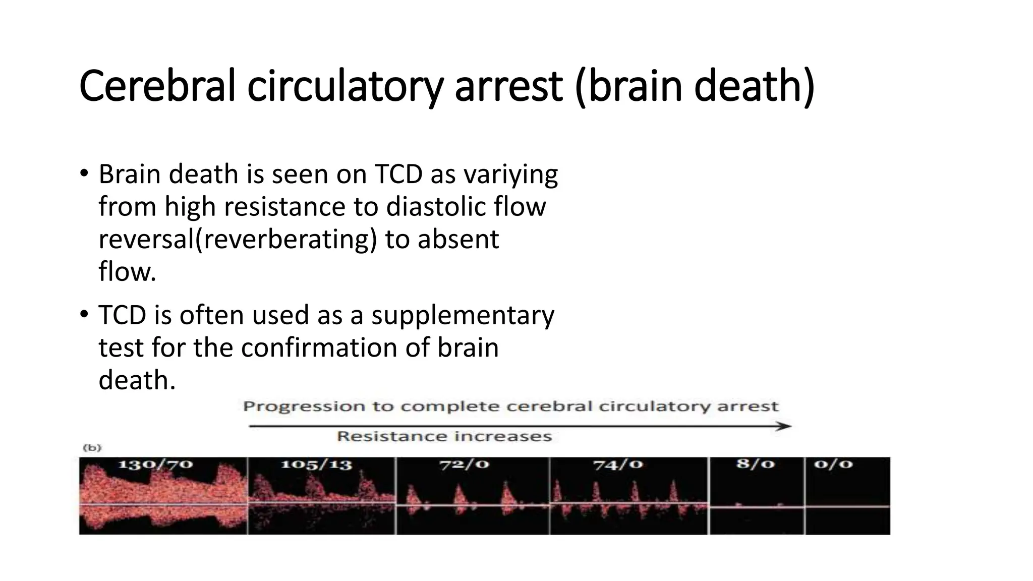 Transcranial doppler ultrasound, principles and procuderes | PPTX