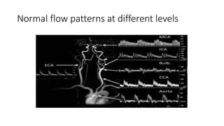 Transcranial doppler ultrasound, principles and procuderes | PPTX