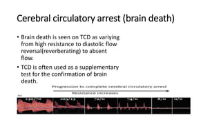 Transcranial doppler ultrasound, principles and procuderes | PPTX