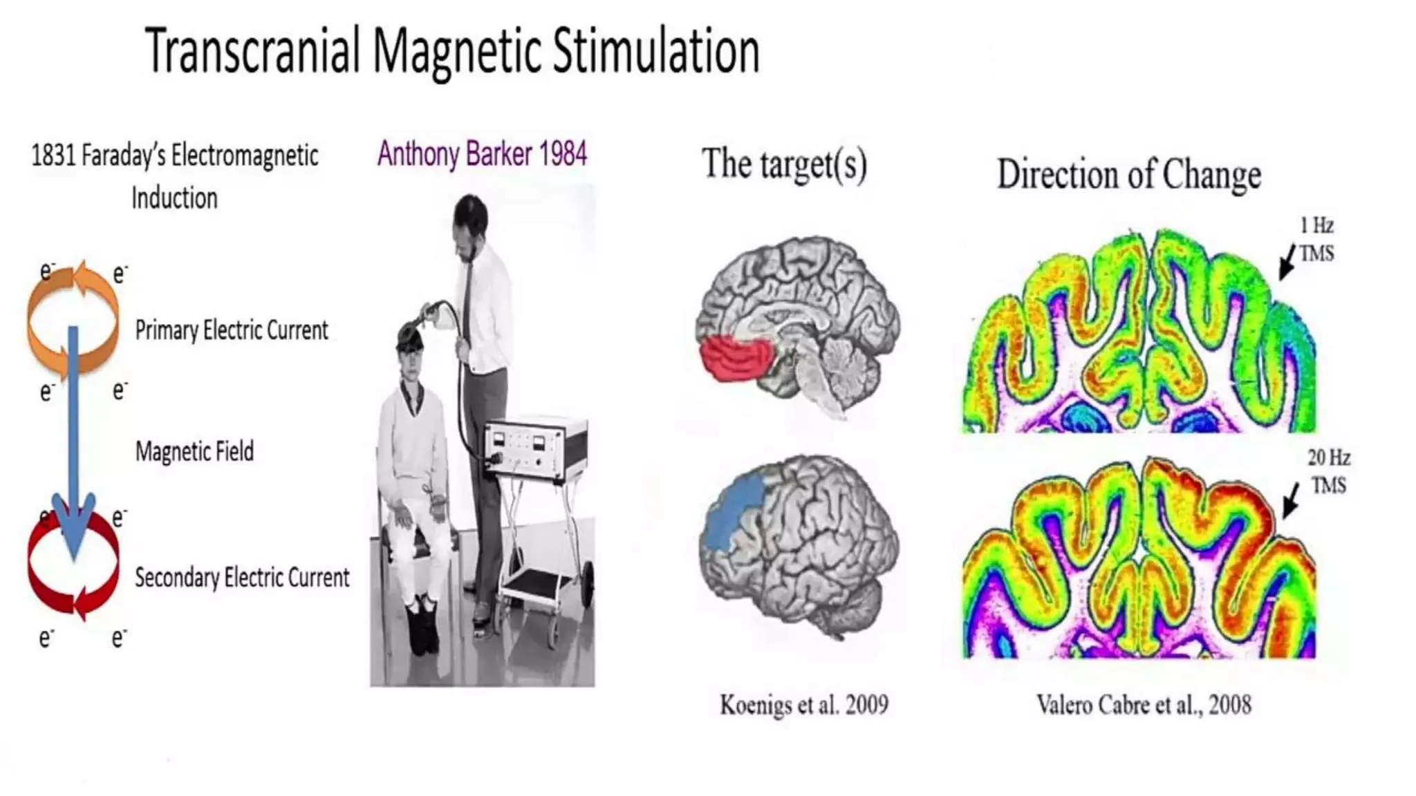 Transcranial magnetic stimulation | PPTX