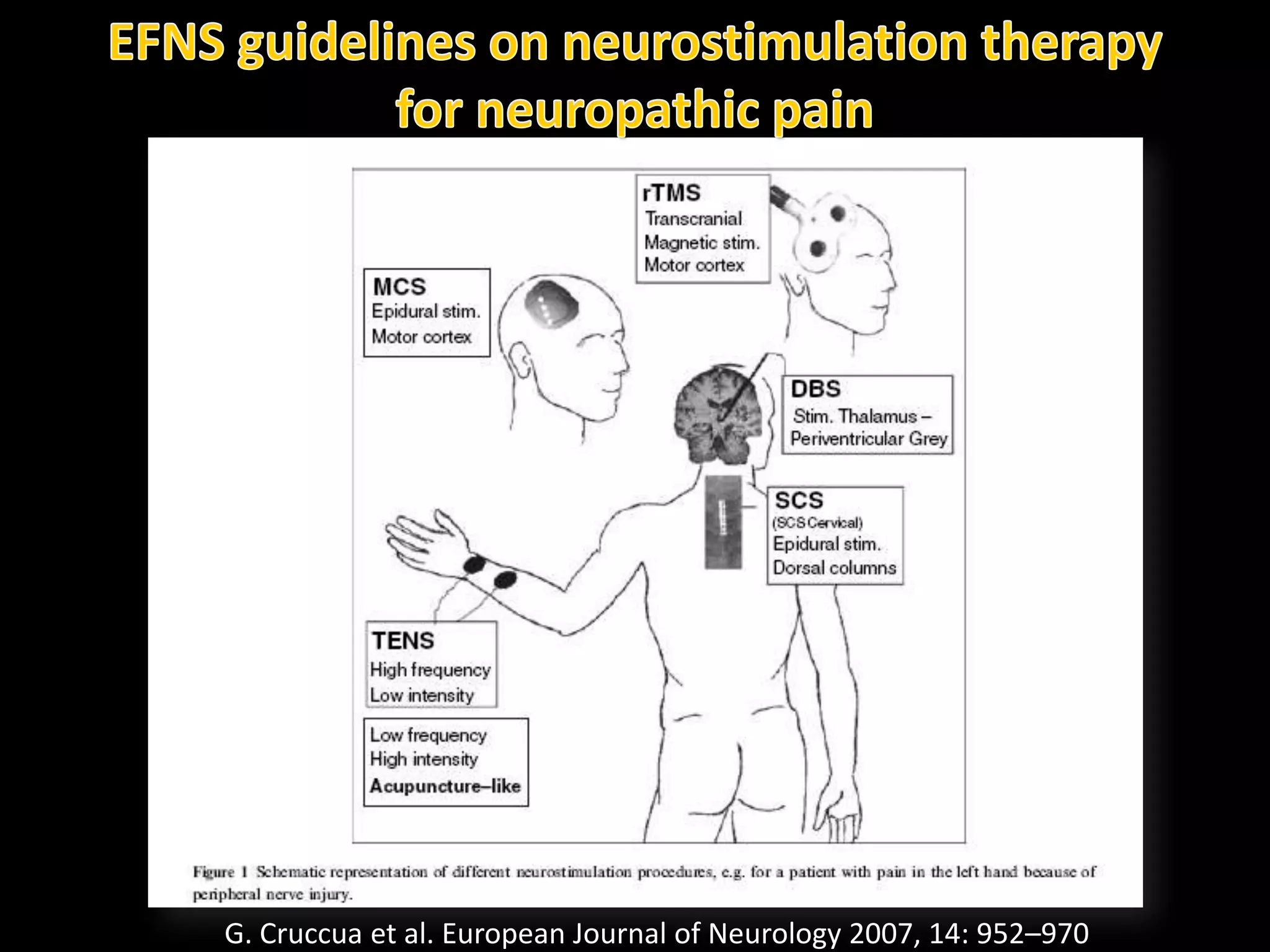 Transcranial Magnetic Stimulation ( TMS) for Chronic Pain | PPTX