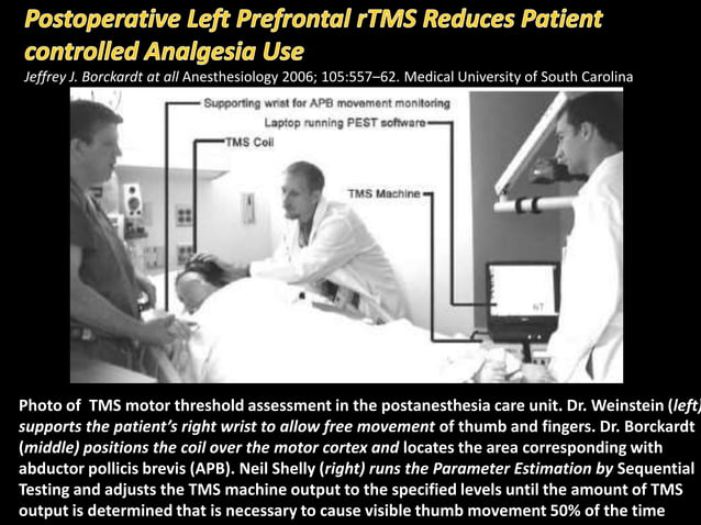 Transcranial Magnetic Stimulation ( TMS) for Chronic Pain | PPTX ...