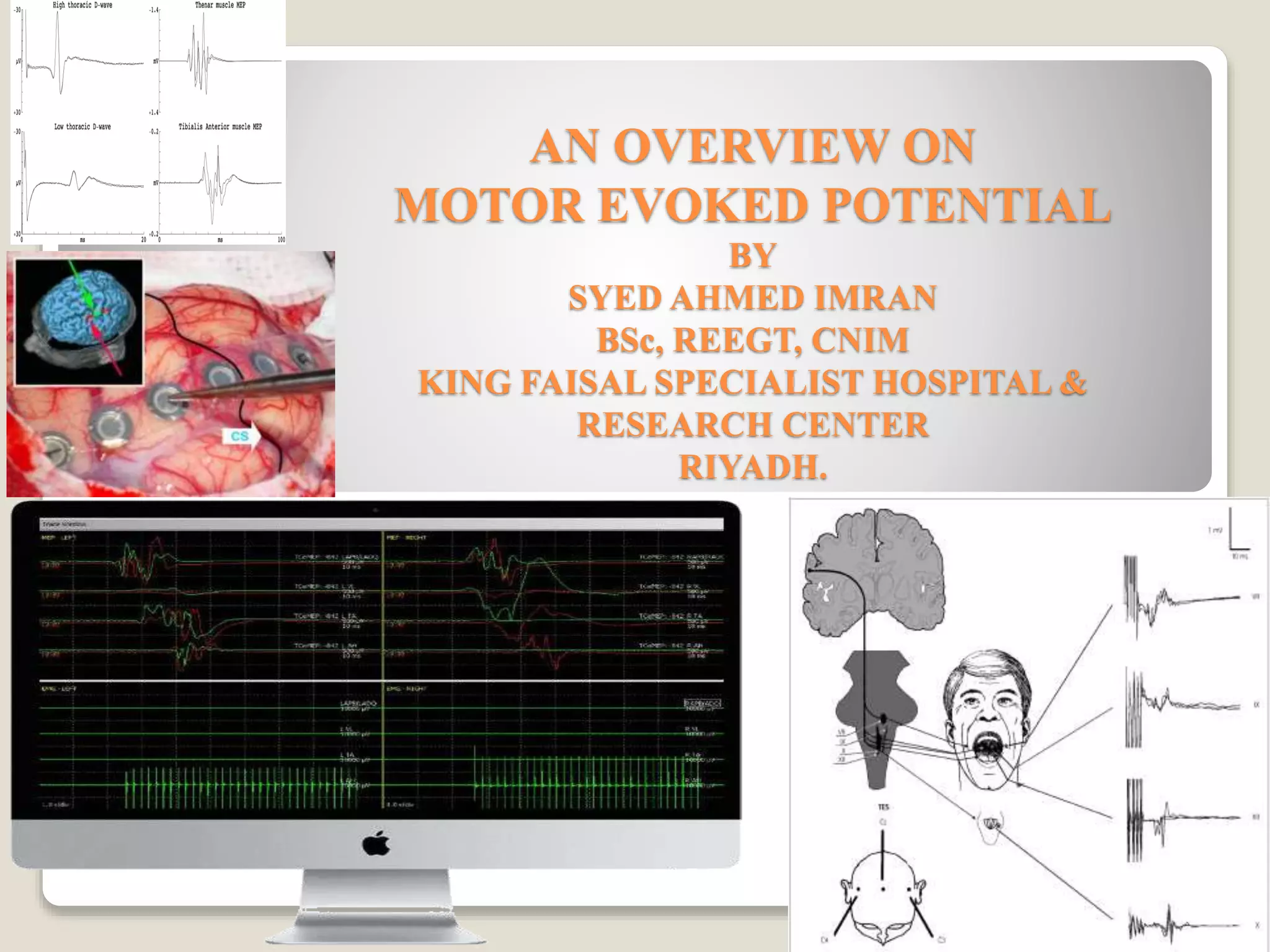 Overview on Motor evoked potential | PPTX