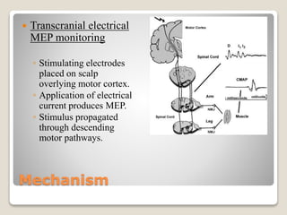 Overview on Motor evoked potential | PPTX