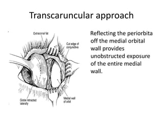 Transcuruncular approach | PPTX | Surgery | Medical Health