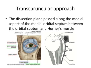 Transcuruncular approach | PPTX | Surgery | Medical Health