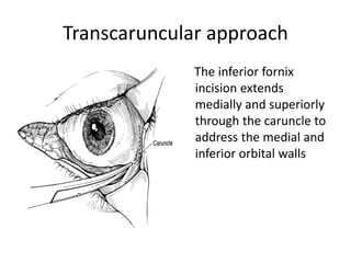 Transcuruncular approach | PPTX | Surgery | Medical Health