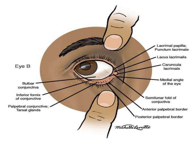 Transcuruncular approach | PPT