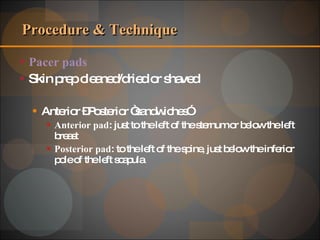 Transcutaneous Pacing | PPT