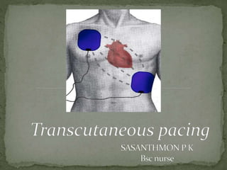 Transcutaneous pacing | PPTX