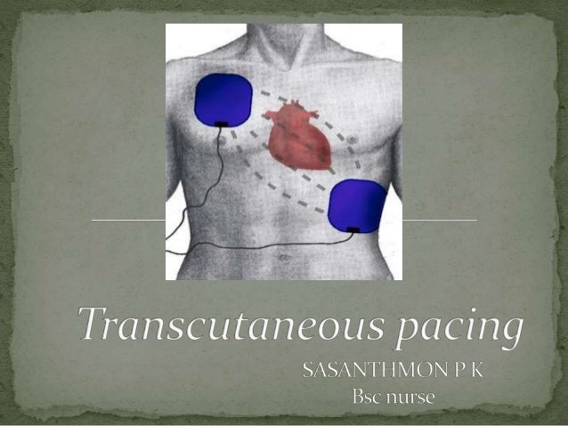 Transcutaneous pacing