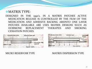 Transdermal drug delivery system | PPTX