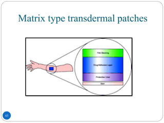 Transdermal drug delivery system | PDF