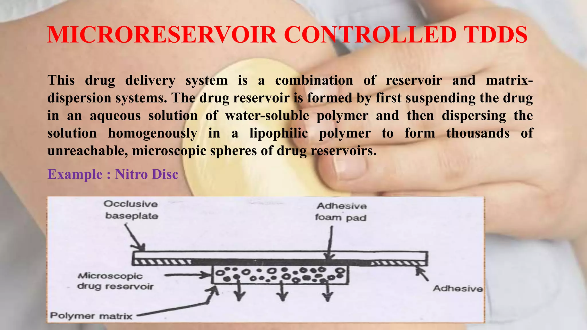 Transdermal drug delivery system (TDDS) it's formulation and evaluation ...