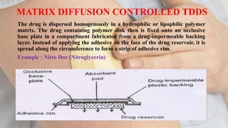 Transdermal drug delivery system (TDDS) it's formulation and evaluation ...