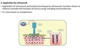 Transdermal drug dleivery sysytem | PPTX