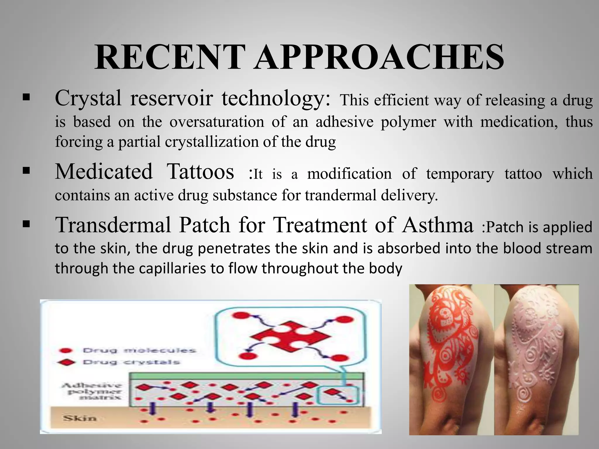 Transdermal patches by Shagufta Nisar | PPTX
