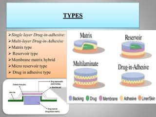 Transdermal Patches: History, Development And Pharmacology, 60% OFF