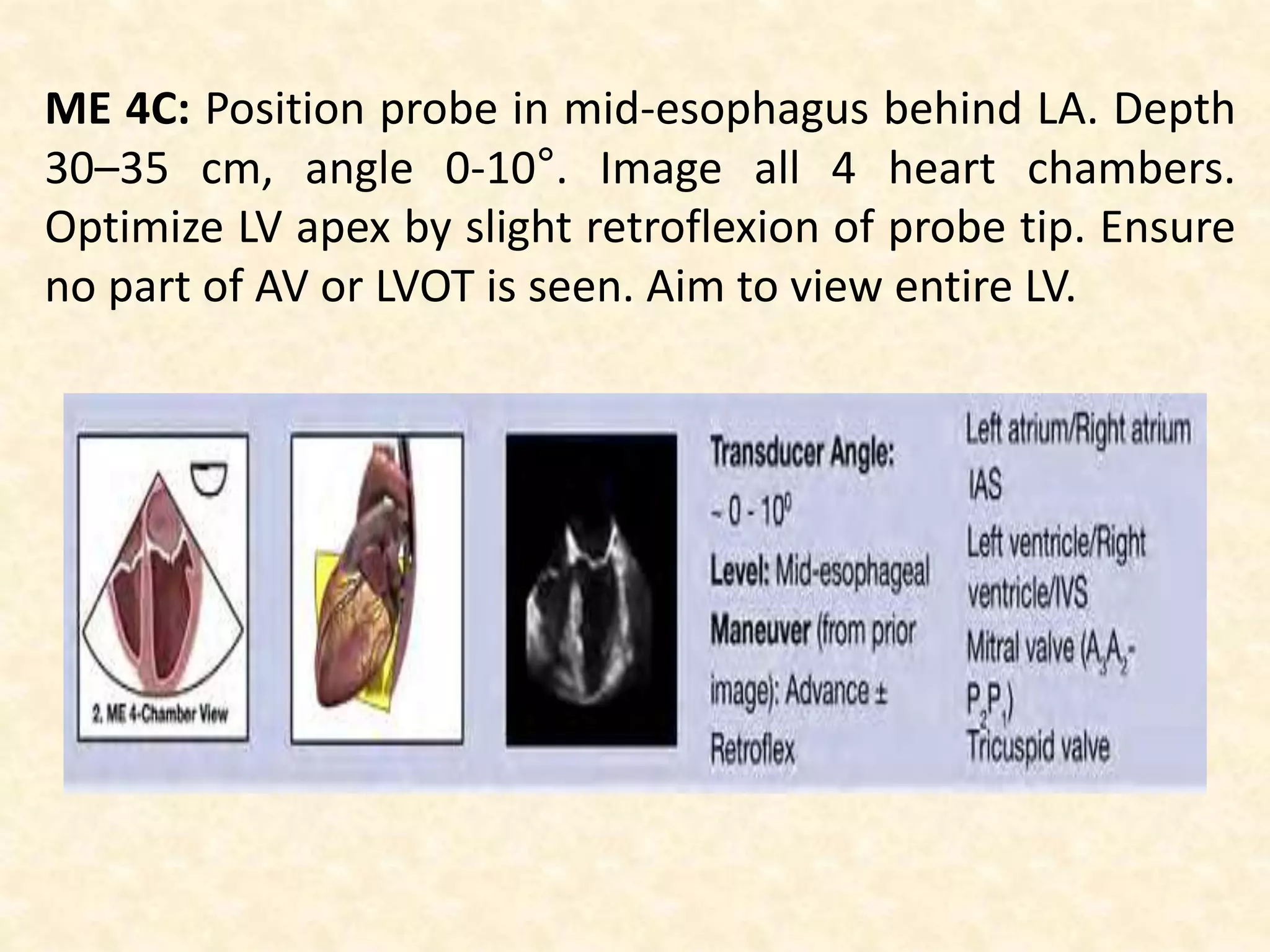 Transesophageal echocardiography | PPSX