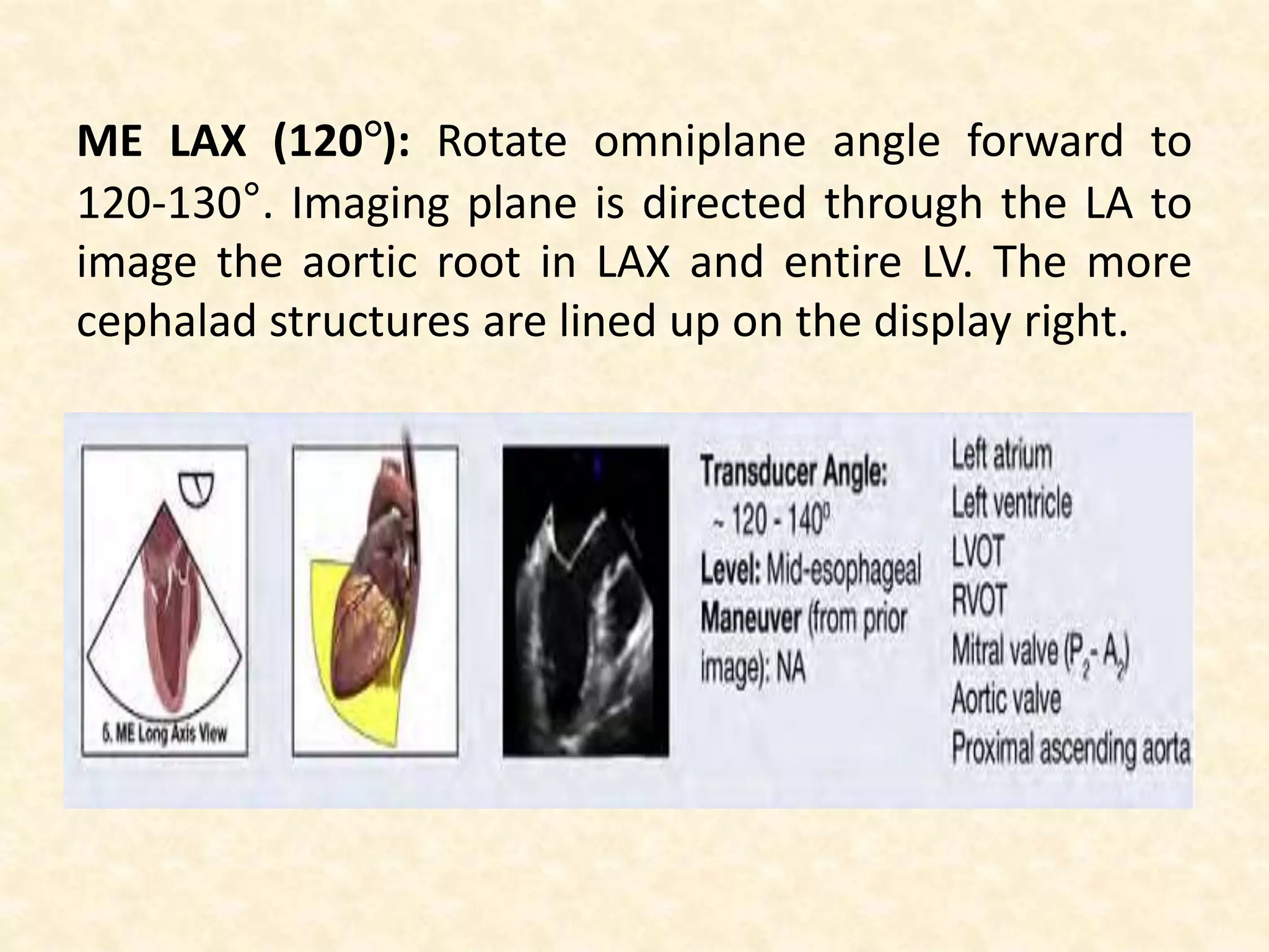 Transesophageal echocardiography | PPSX