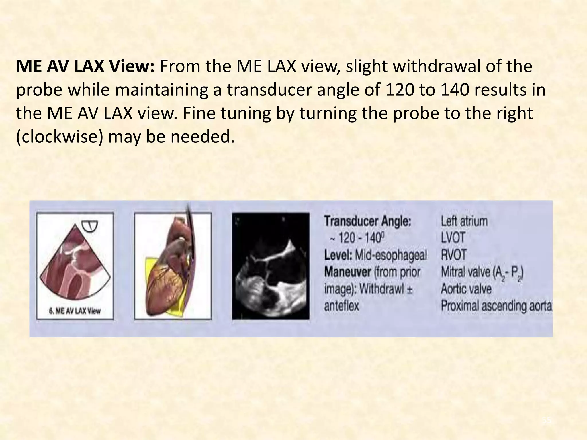 Transesophageal echocardiography | PPSX