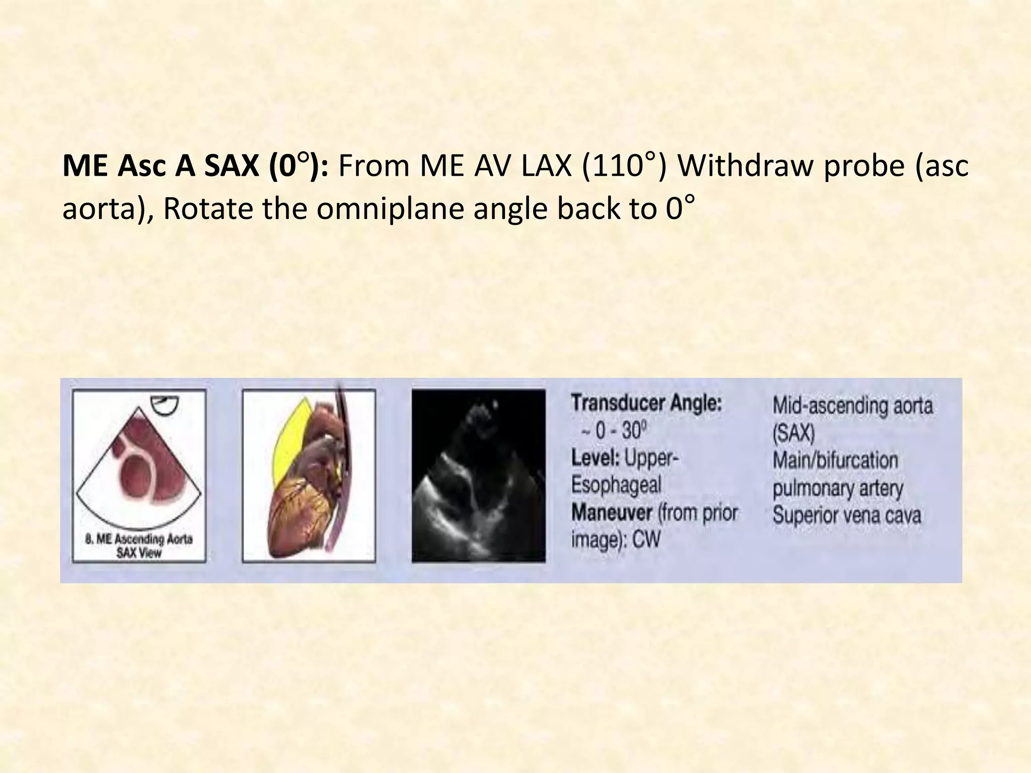 Transesophageal echocardiography | PPSX