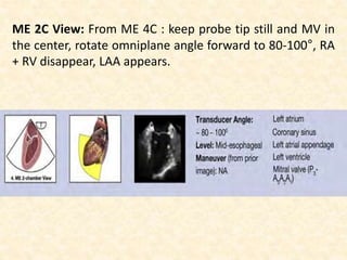 Transesophageal echocardiography | PPSX