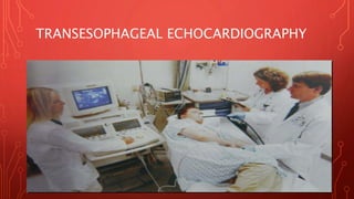 Transesophageal echocardiography | PPTX