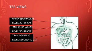 Transesophageal echocardiography | PPTX