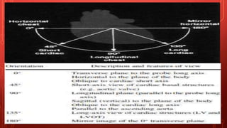 Transesophageal echocardiography | PPTX