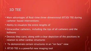 Transesophageal echocardiography | PPTX
