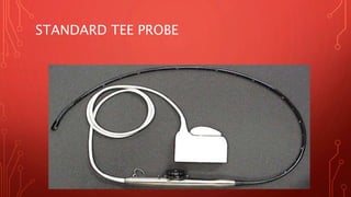 Transesophageal echocardiography | PPTX