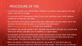 Transesophageal echocardiography | PPTX