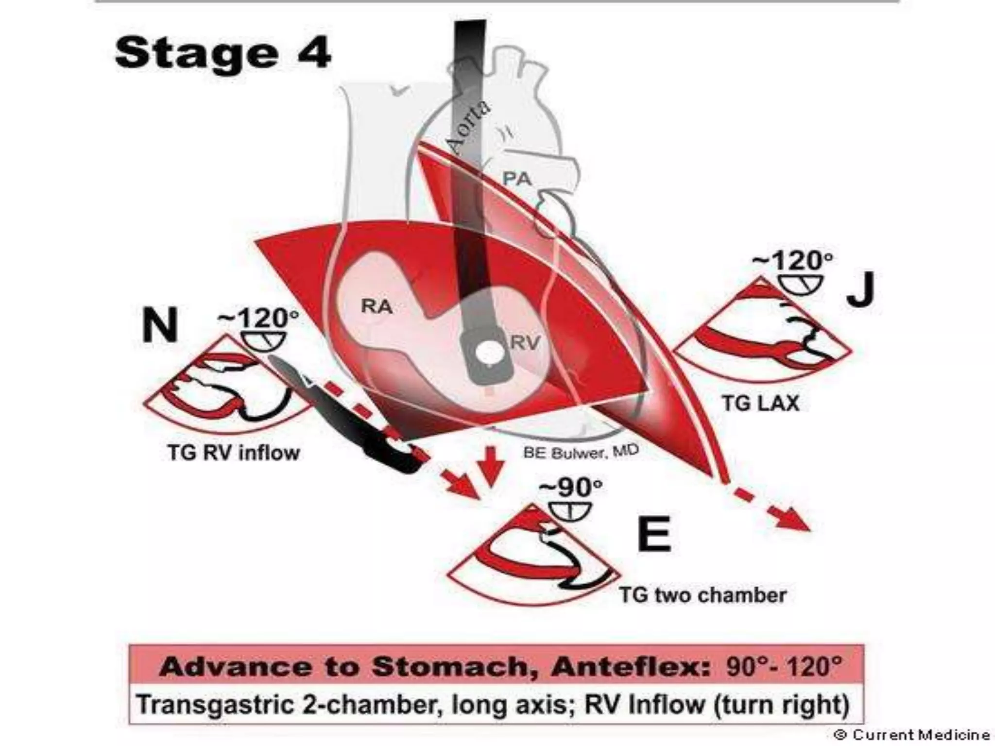 Transesophageal echocardiography(TEE) | PPTX