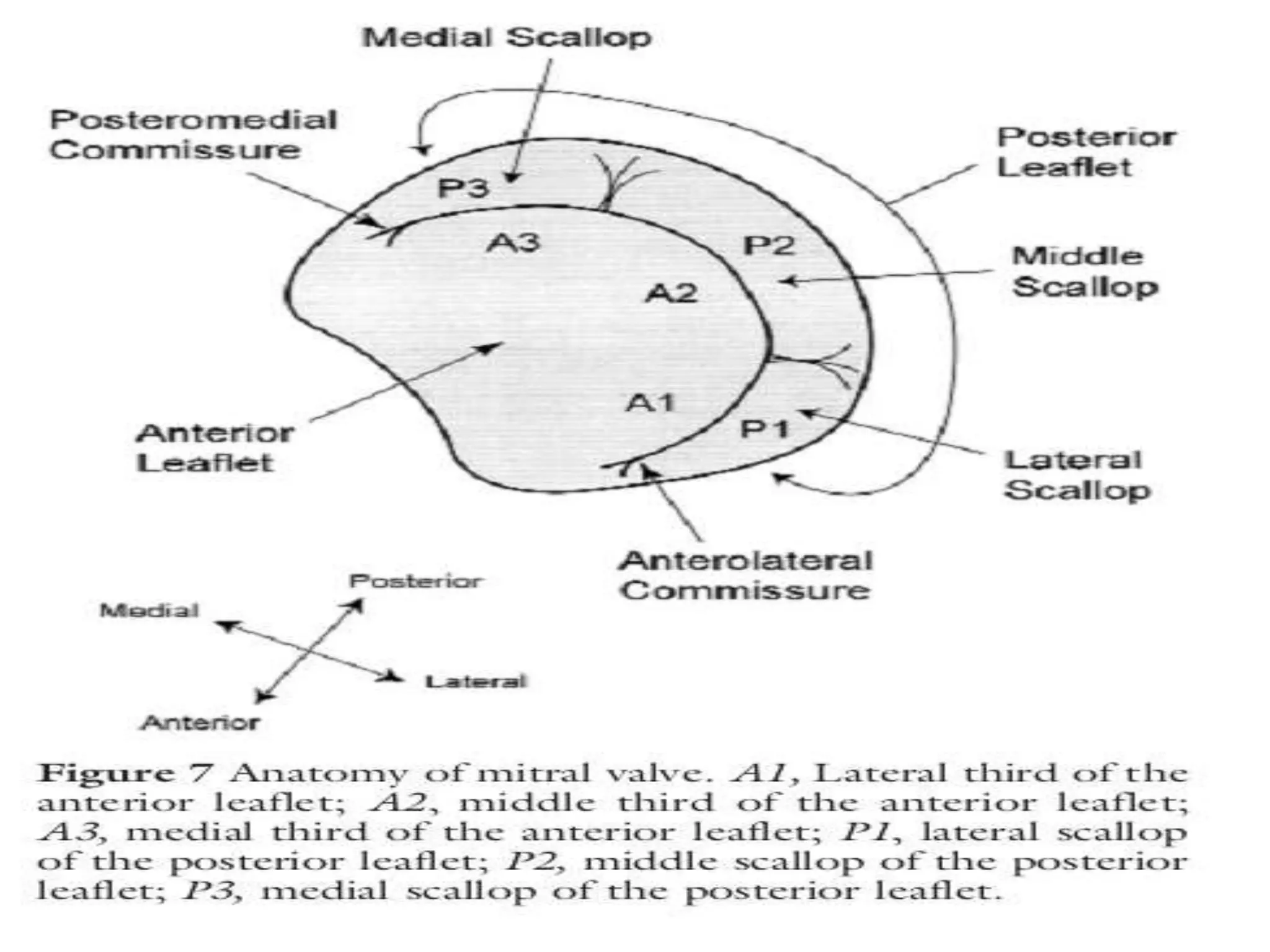 Transesophageal echocardiography(TEE) | PPTX