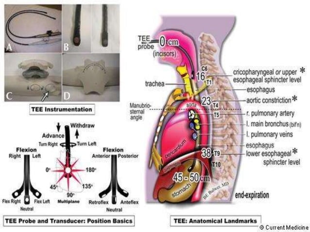 Transesophageal echocardiography(TEE) | PPTX