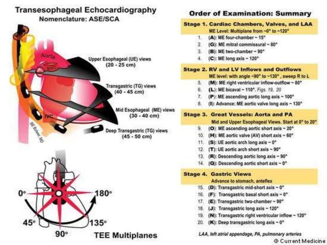 Transesophageal echocardiography(TEE) | PPTX