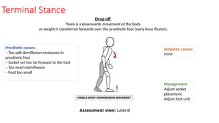 TRANSFEMORAL GAIT DEVIATIONS with causes and managment | PPTX