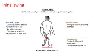 TRANSFEMORAL GAIT DEVIATIONS with causes and managment | PPTX
