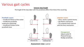 TRANSFEMORAL GAIT DEVIATIONS with causes and managment | PPTX