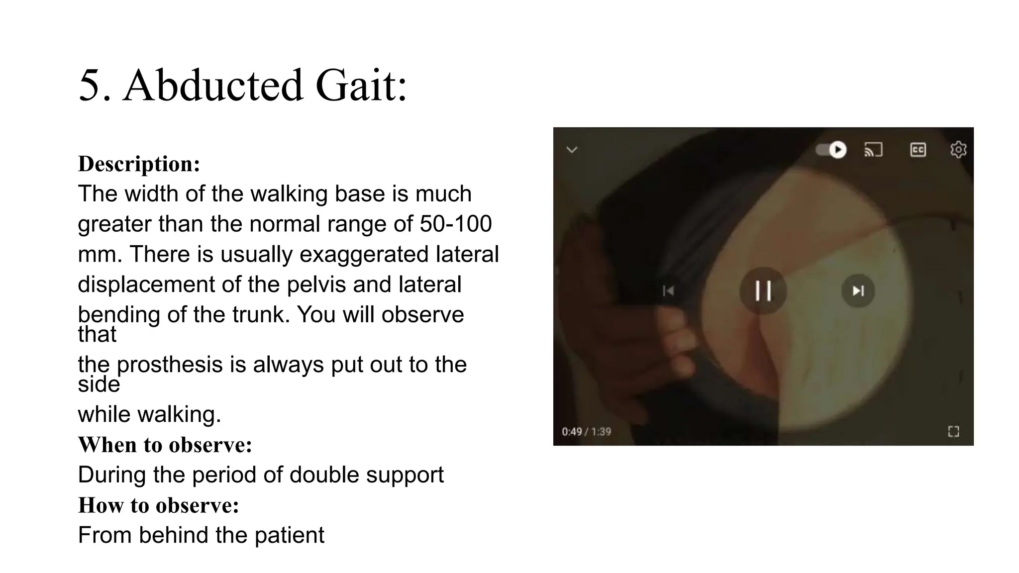 Transfemoral Prosthesis Gait Deviations.pptx