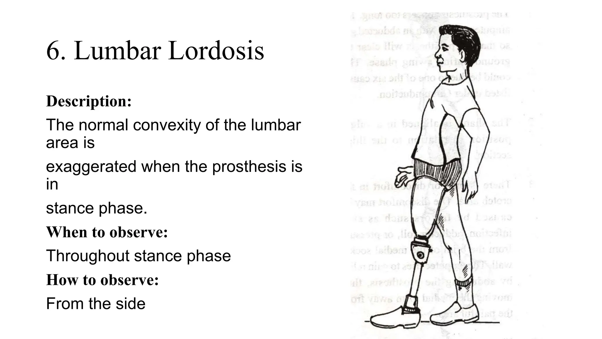 Transfemoral Prosthesis Gait Deviations.pptx