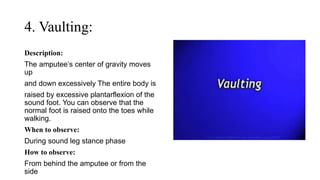 Transfemoral Prosthesis Gait Deviations.pptx