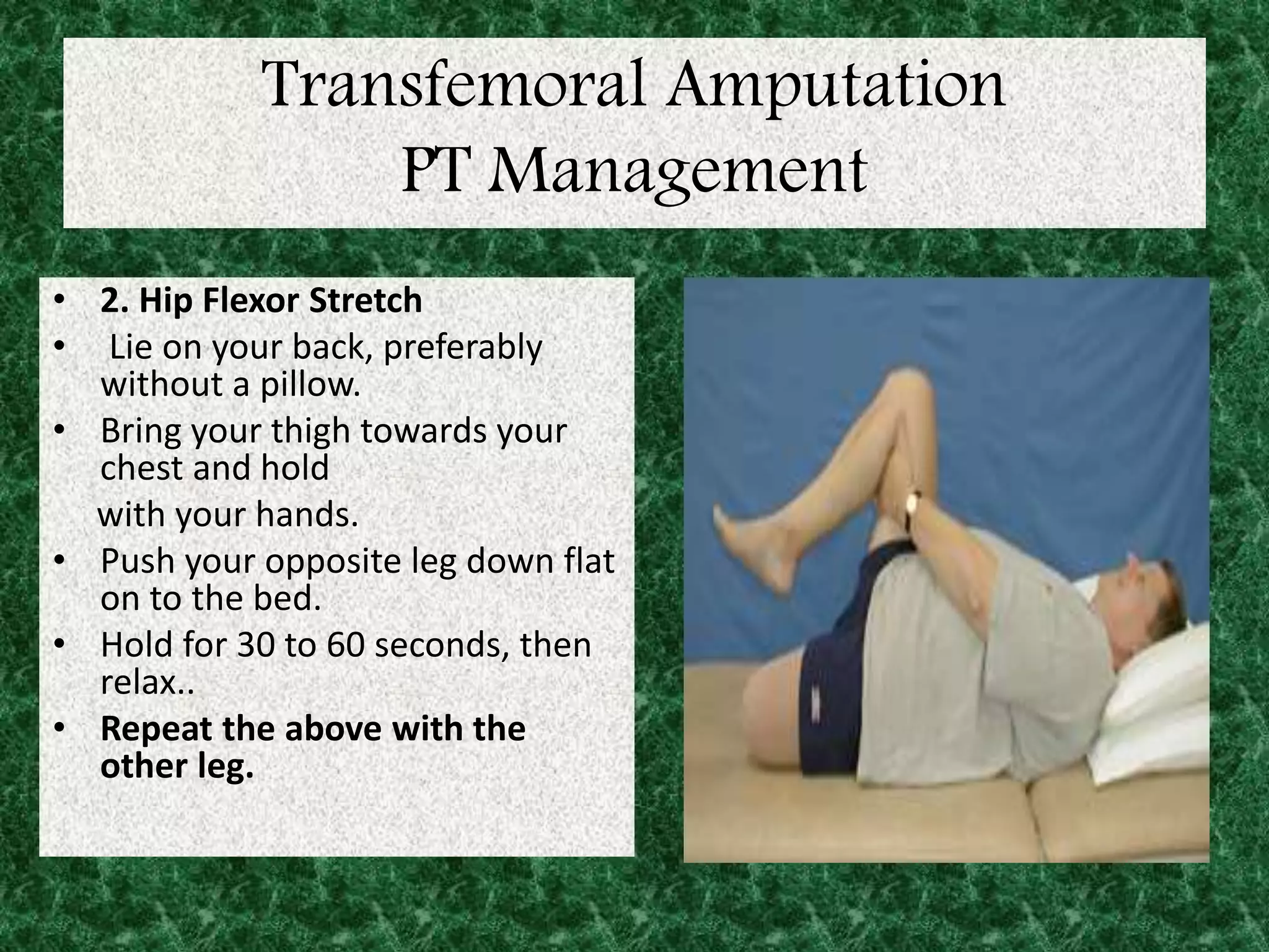 Transfemoral protheses | PPTX