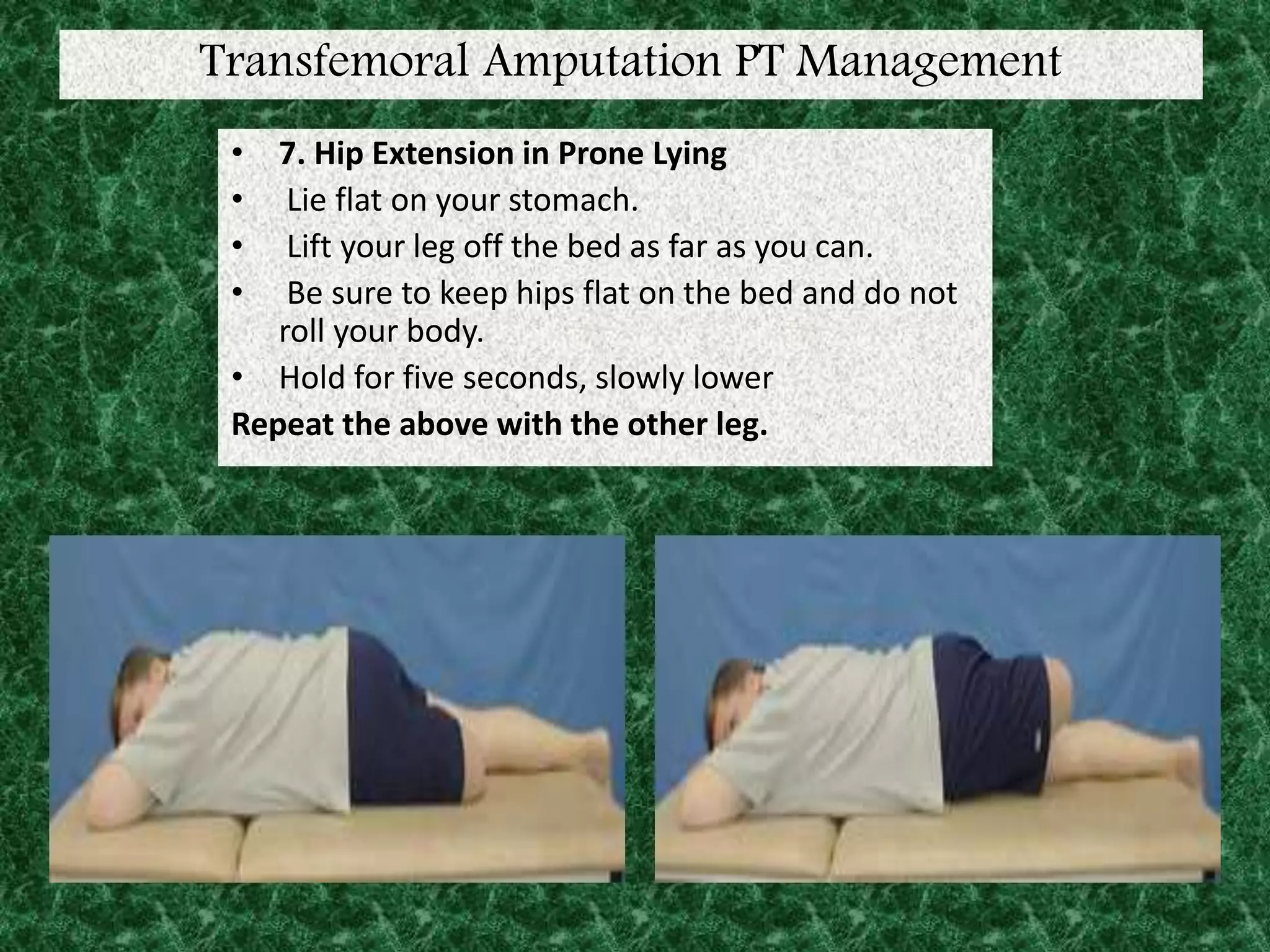 Transfemoral protheses | PPTX