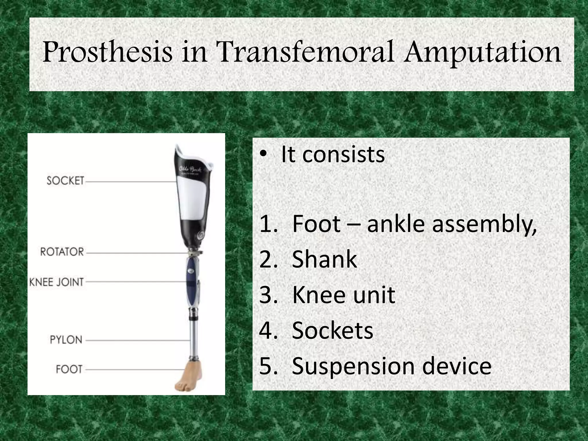Transfemoral protheses | PPTX