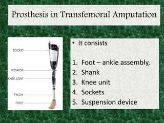 Transfemoral protheses | PPTX