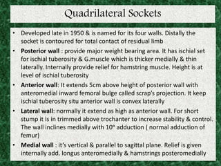 Transfemoral protheses | PPTX