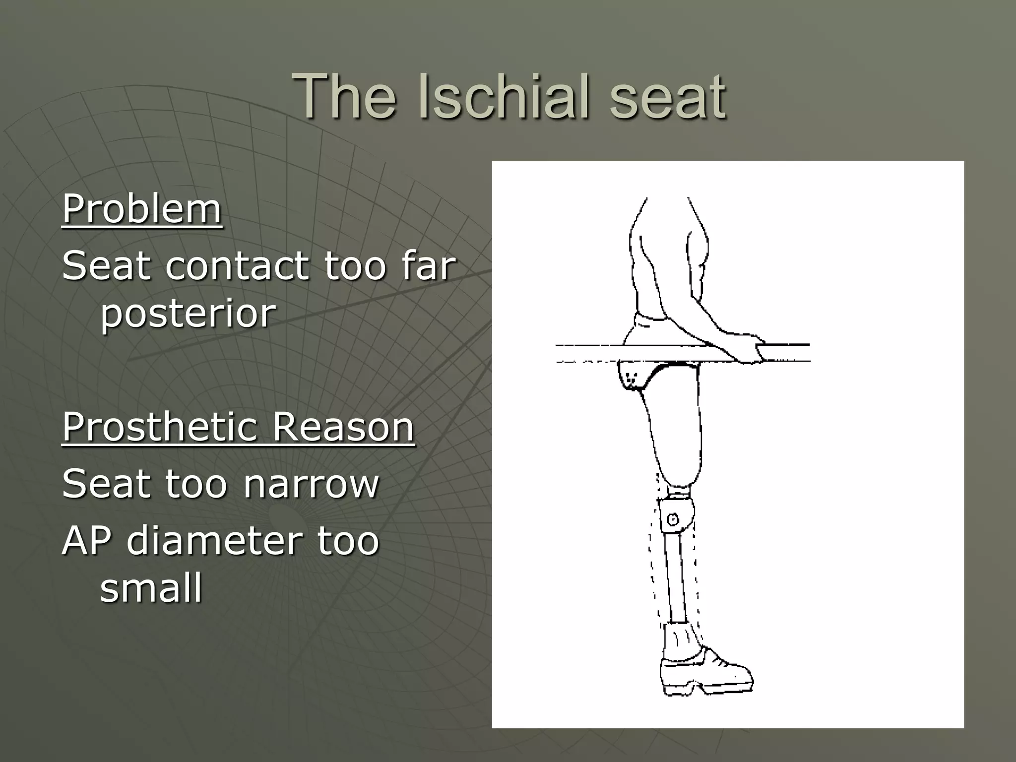 Transfemoral Socket Problems.ppt