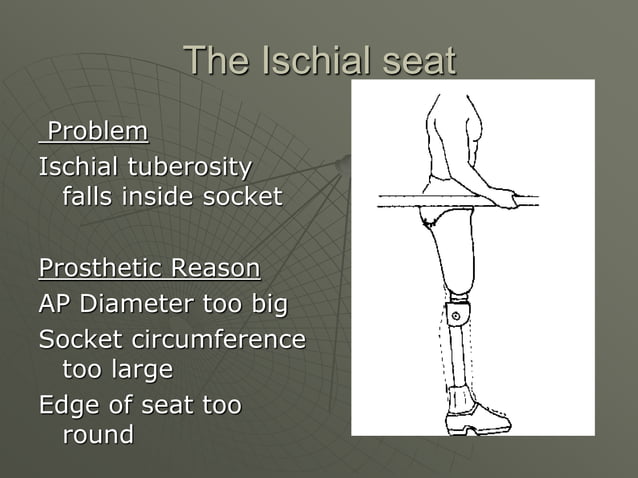 Transfemoral Socket Problems.ppt